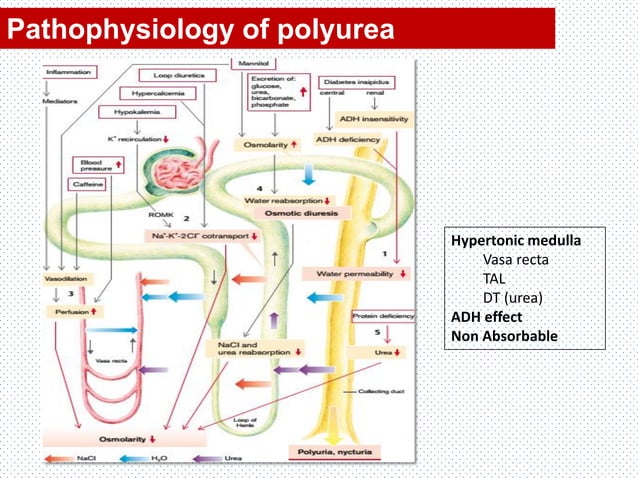 Polyuria : BASICS AND APPROACH | PDF
