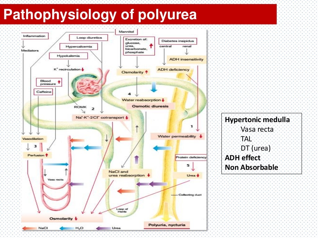Polyuria : BASICS AND APPROACH