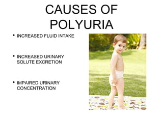 Polyuria approach | PPTX