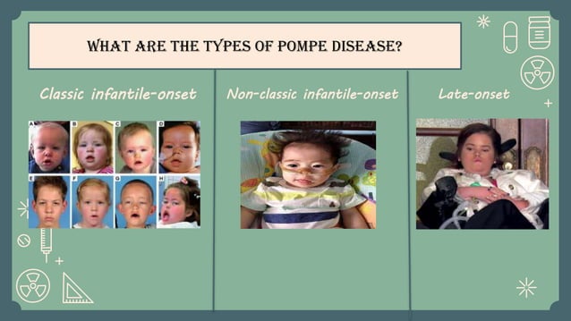 pompe-disease. its definition-study. pptx | PPTX