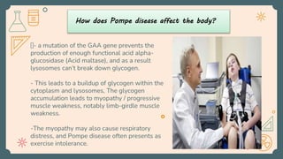pompe-disease. its definition-study. pptx | PPTX