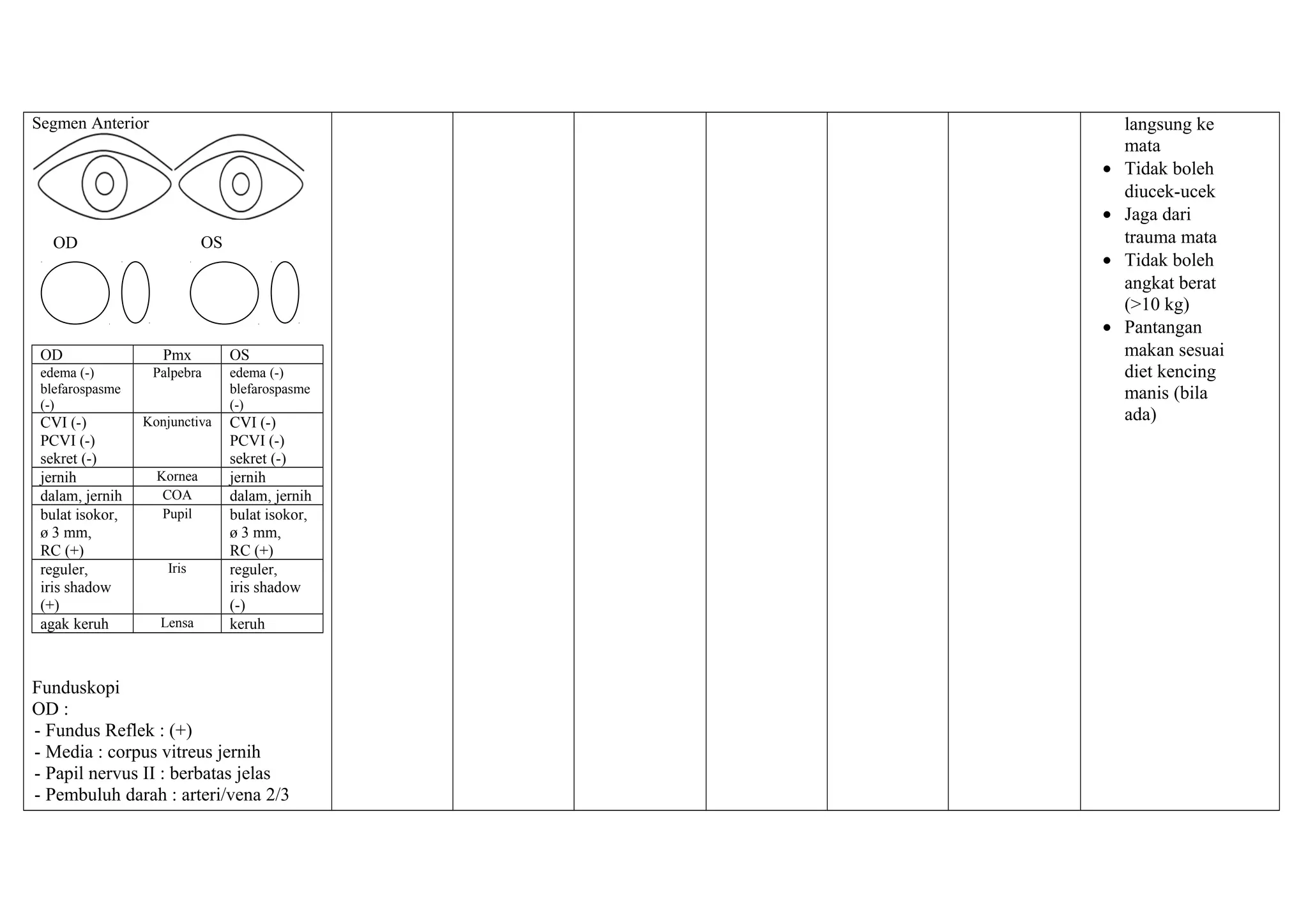Pomr katarak iyor | DOC