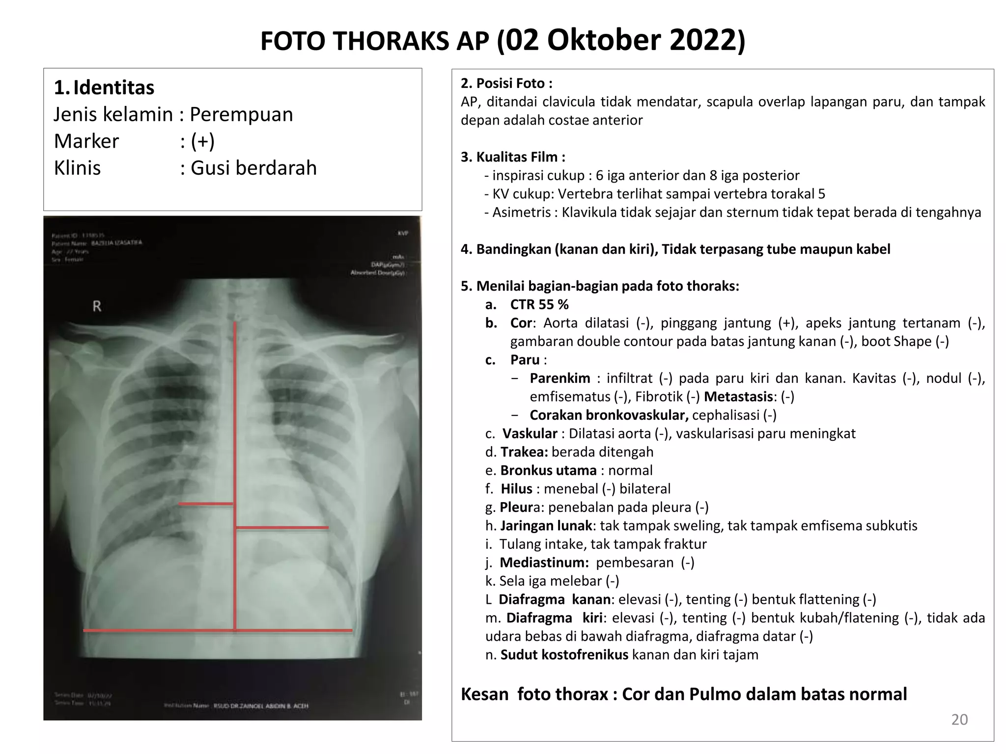 POMR Minggu Pagi edit 1.pptx