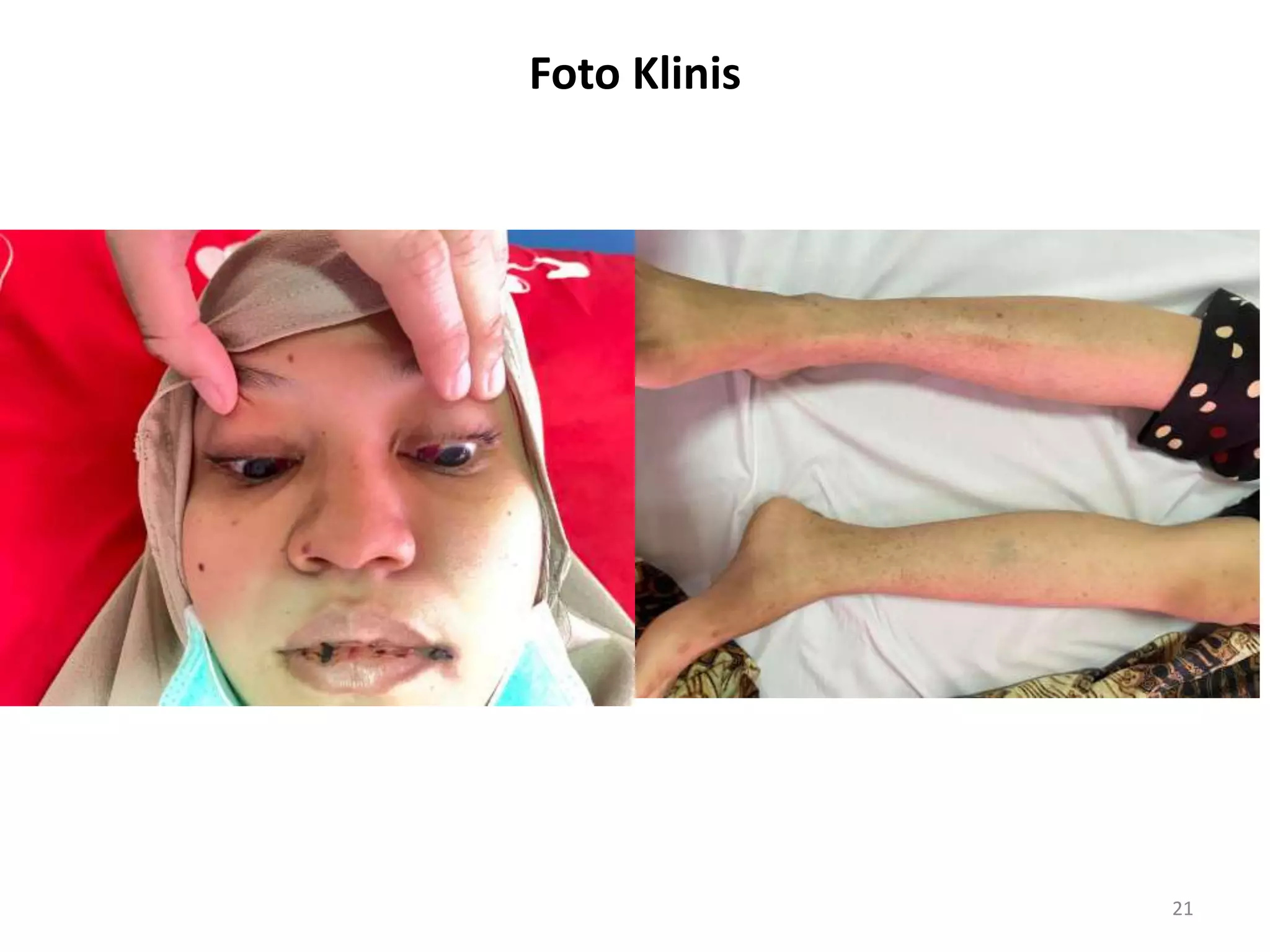 POMR Minggu Pagi edit 1.pptx