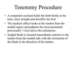 Ponceti techniqe | PPTX