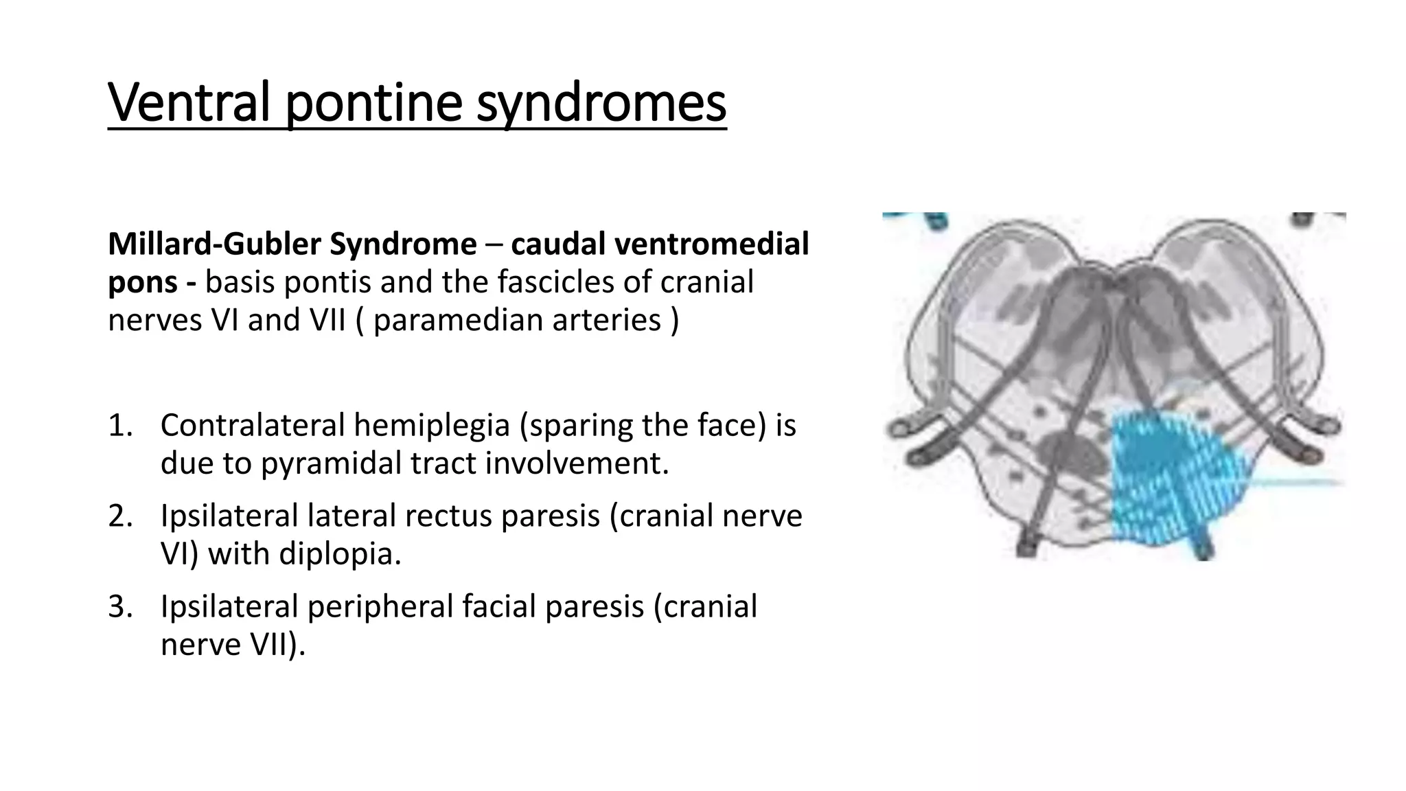 Anatomy of Pons | PPTX