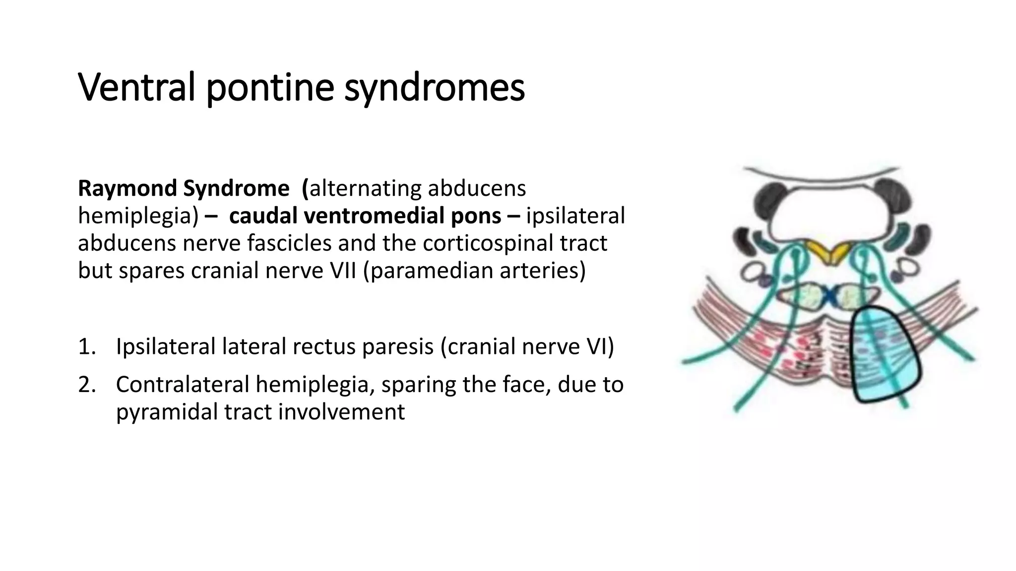 Anatomy of Pons | PPTX