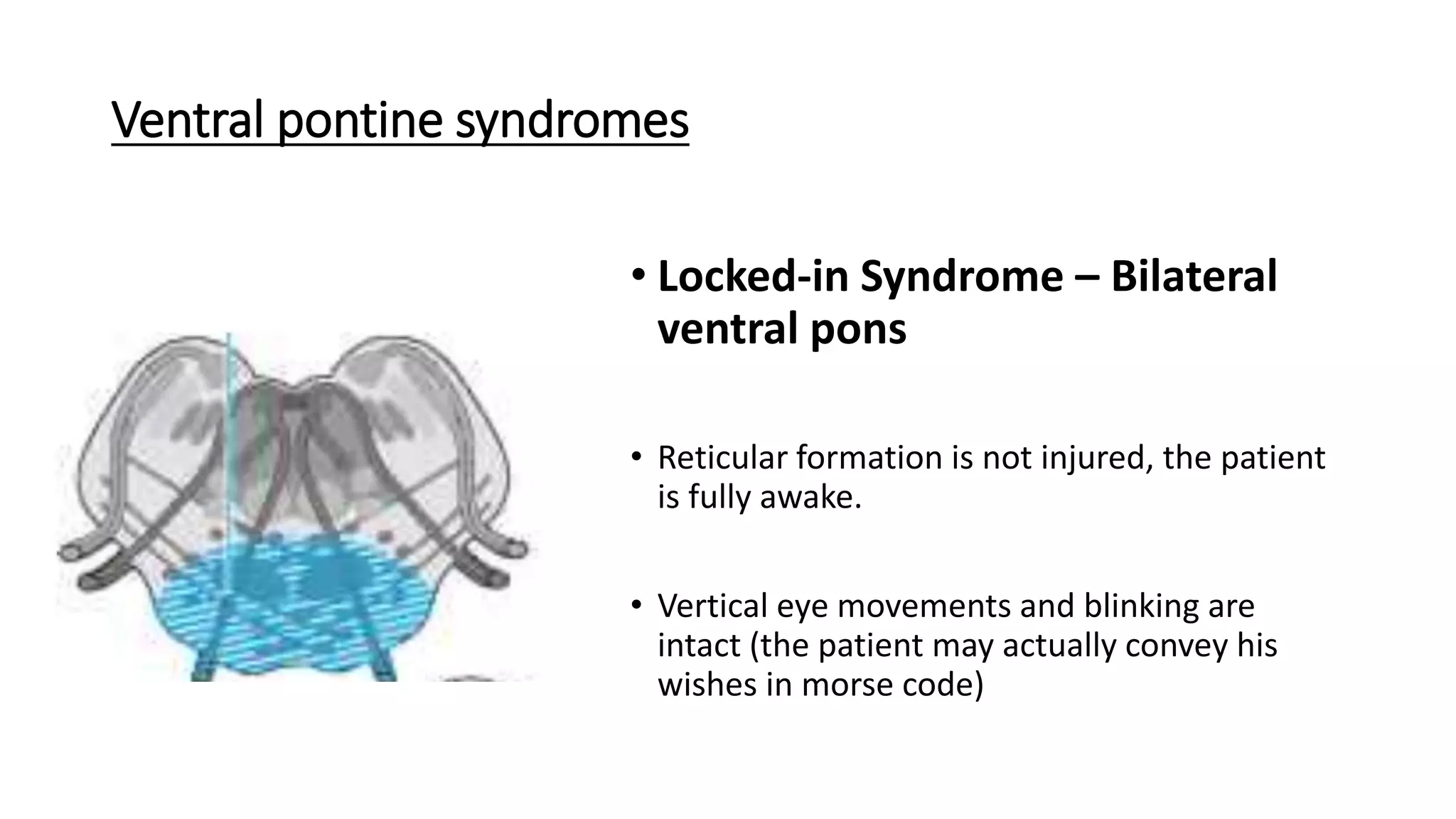 Anatomy of Pons | PPTX