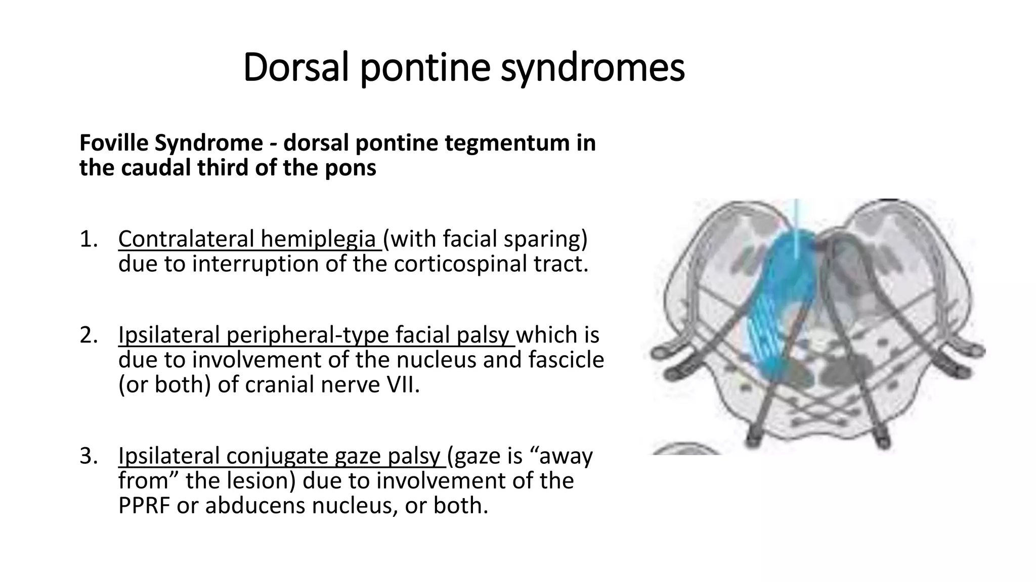 Anatomy of Pons | PPTX