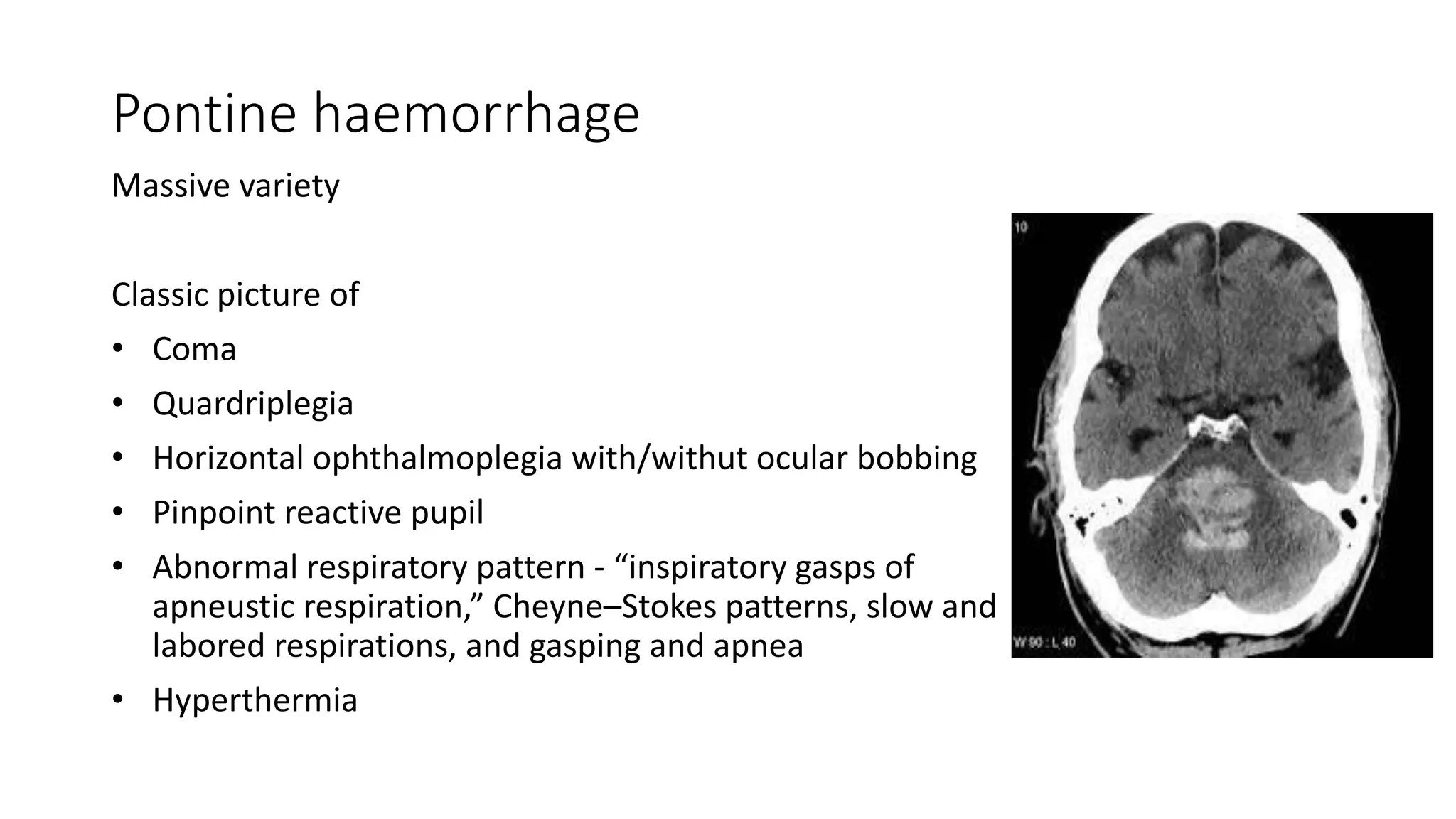 Anatomy of Pons | PPTX