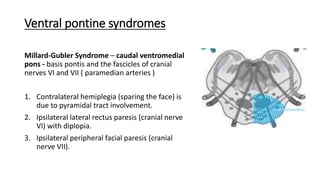 Anatomy of Pons | PPTX