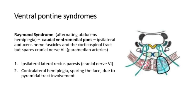 Anatomy of Pons | PPTX | Death, Injury, or Military Conflict ...