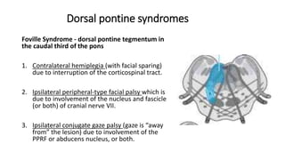 Anatomy of Pons | PPTX