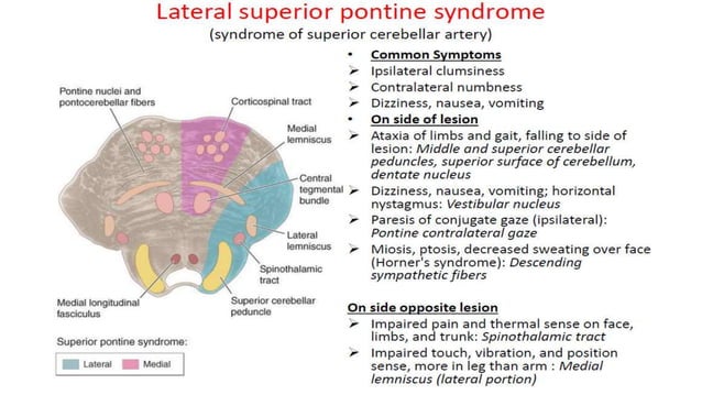 Anatomy of Pons | PPTX | Death, Injury, or Military Conflict ...