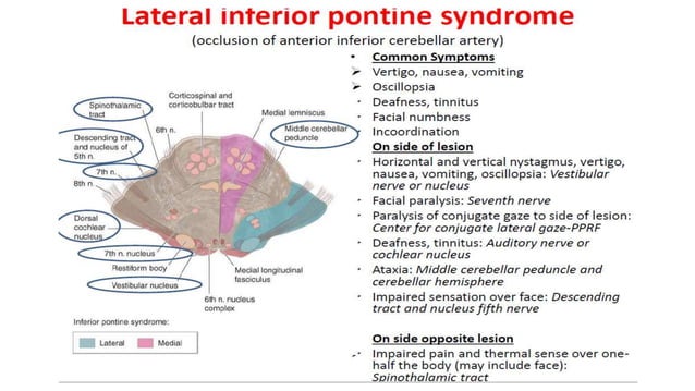 Anatomy of Pons | PPTX | Death, Injury, or Military Conflict ...