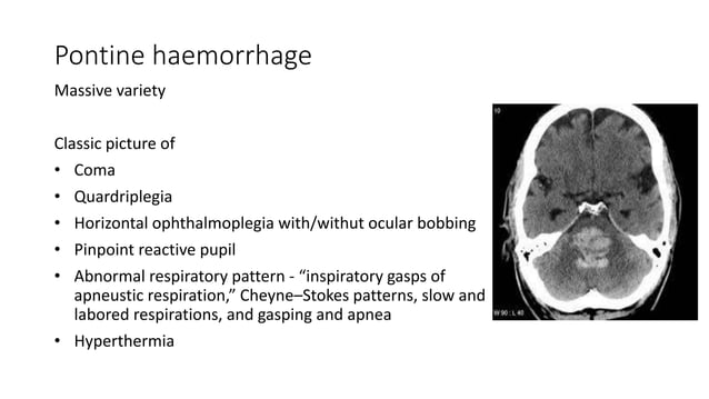 Anatomy of Pons | PPTX | Death, Injury, or Military Conflict ...