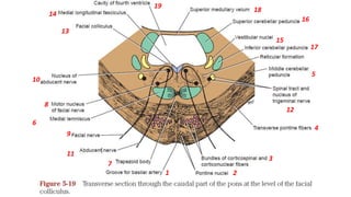 Pons cross sectional anatomy - Dr Sameep Koshti (consultant ...