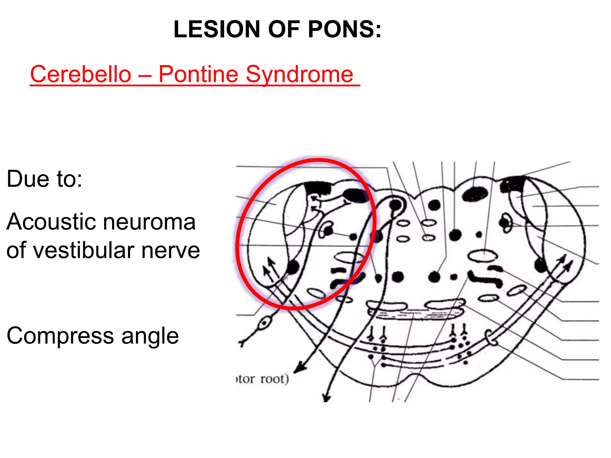 Pons Anatomy | PPTX