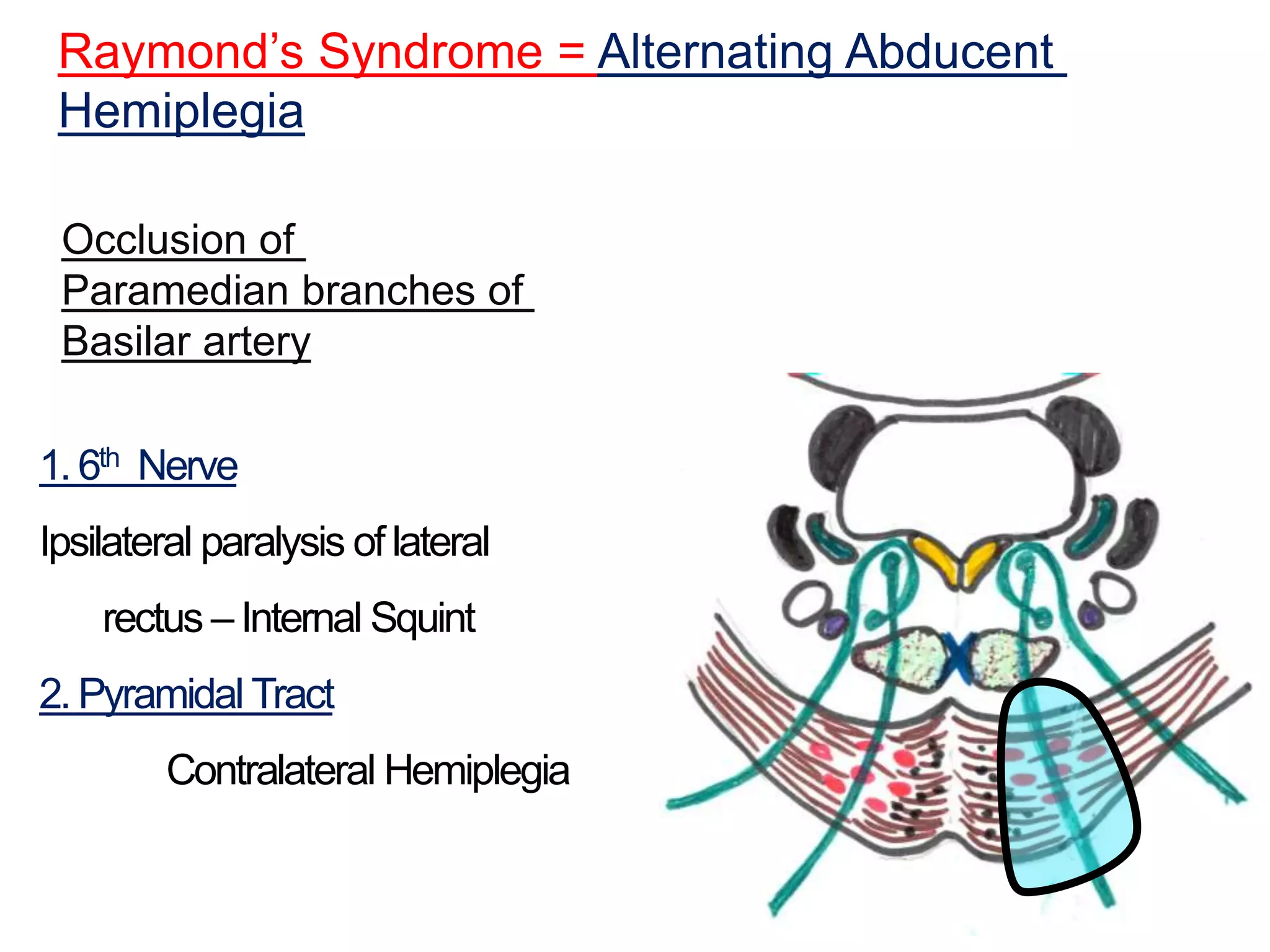 Pons Anatomy | PPTX