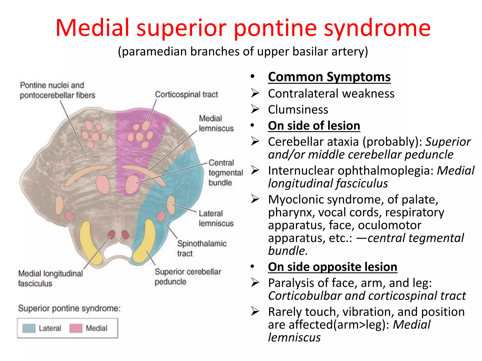 Pons anatomy and syndromes | PPTX