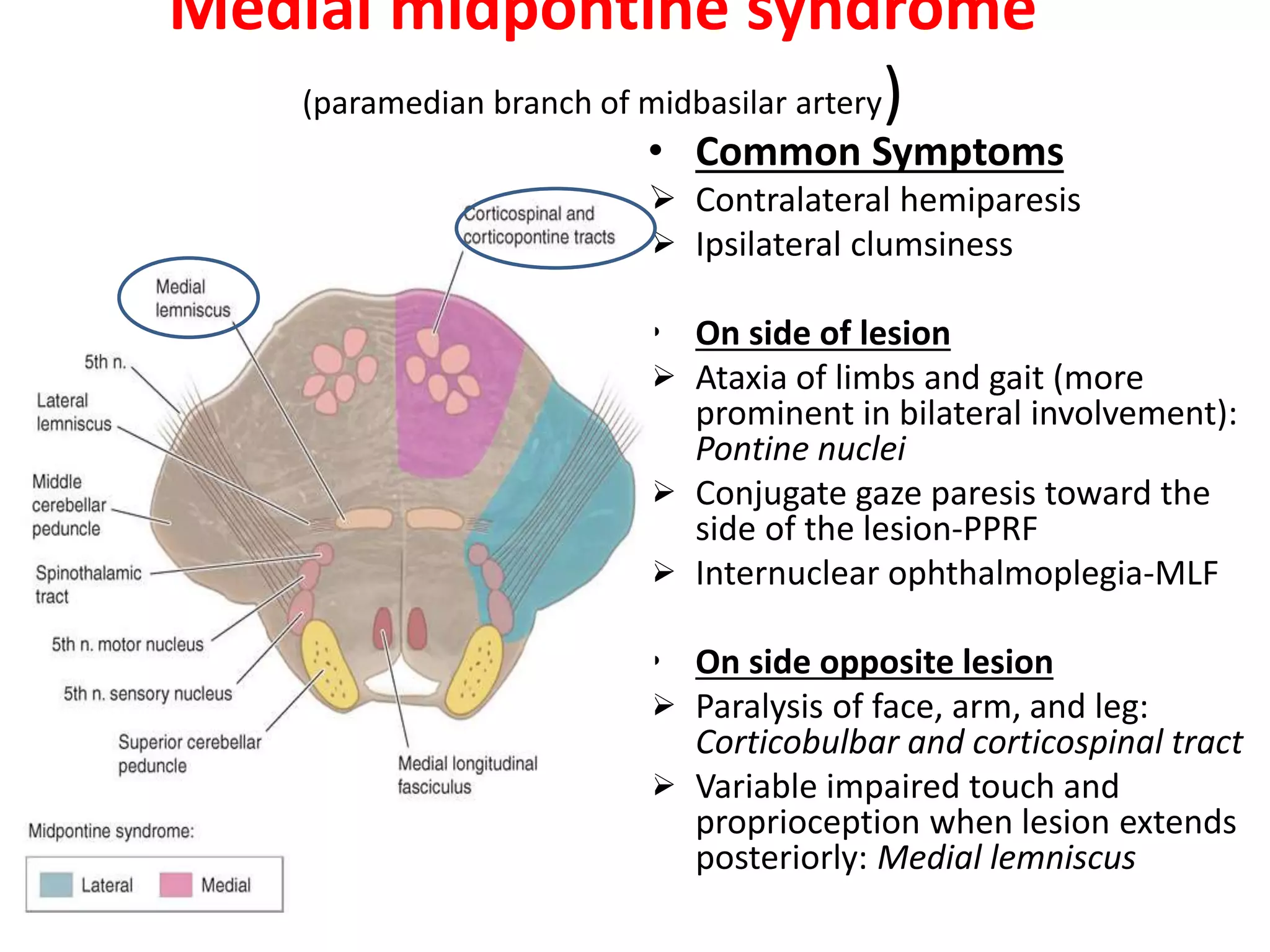 Pons anatomy and syndromes | PPTX