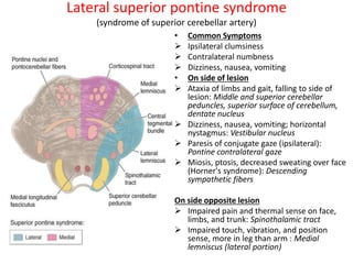 Lateral Pontine Syndrome Mri