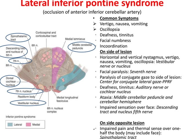 Pons anatomy and syndromes