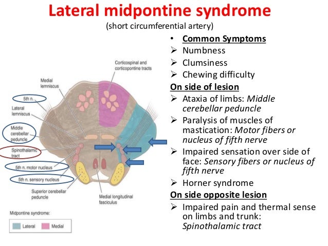 Pons anatomy and syndromes