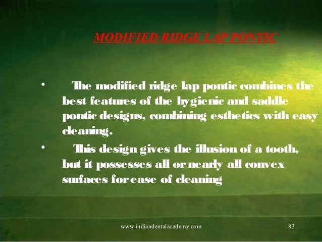 Pontic/ orthodontic straight wire technique