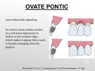 PONTICS IN FIXED PARTIAL DENTURE FOR ORAL | PPT