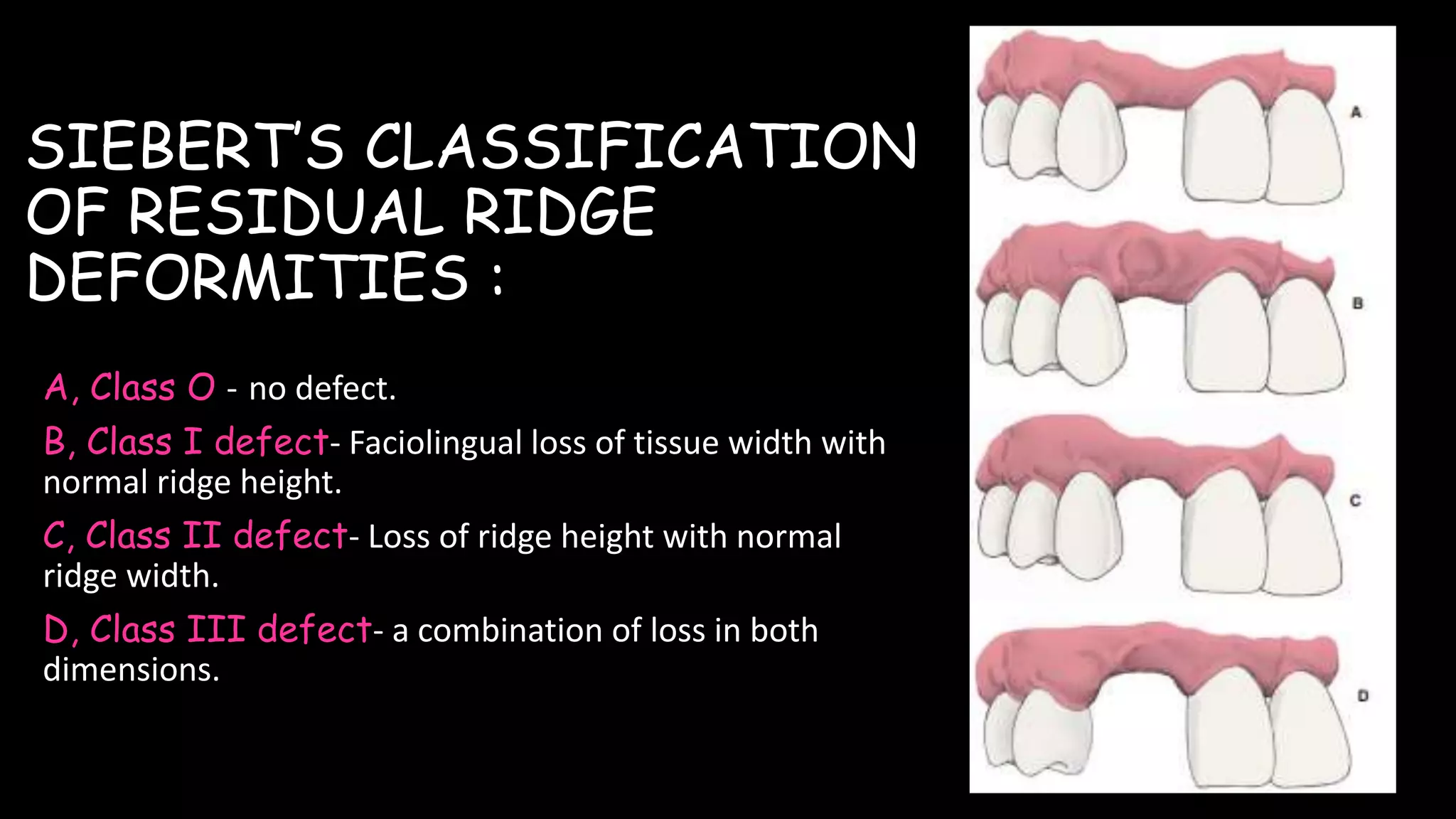 Pontic and pontic designs | PPTX