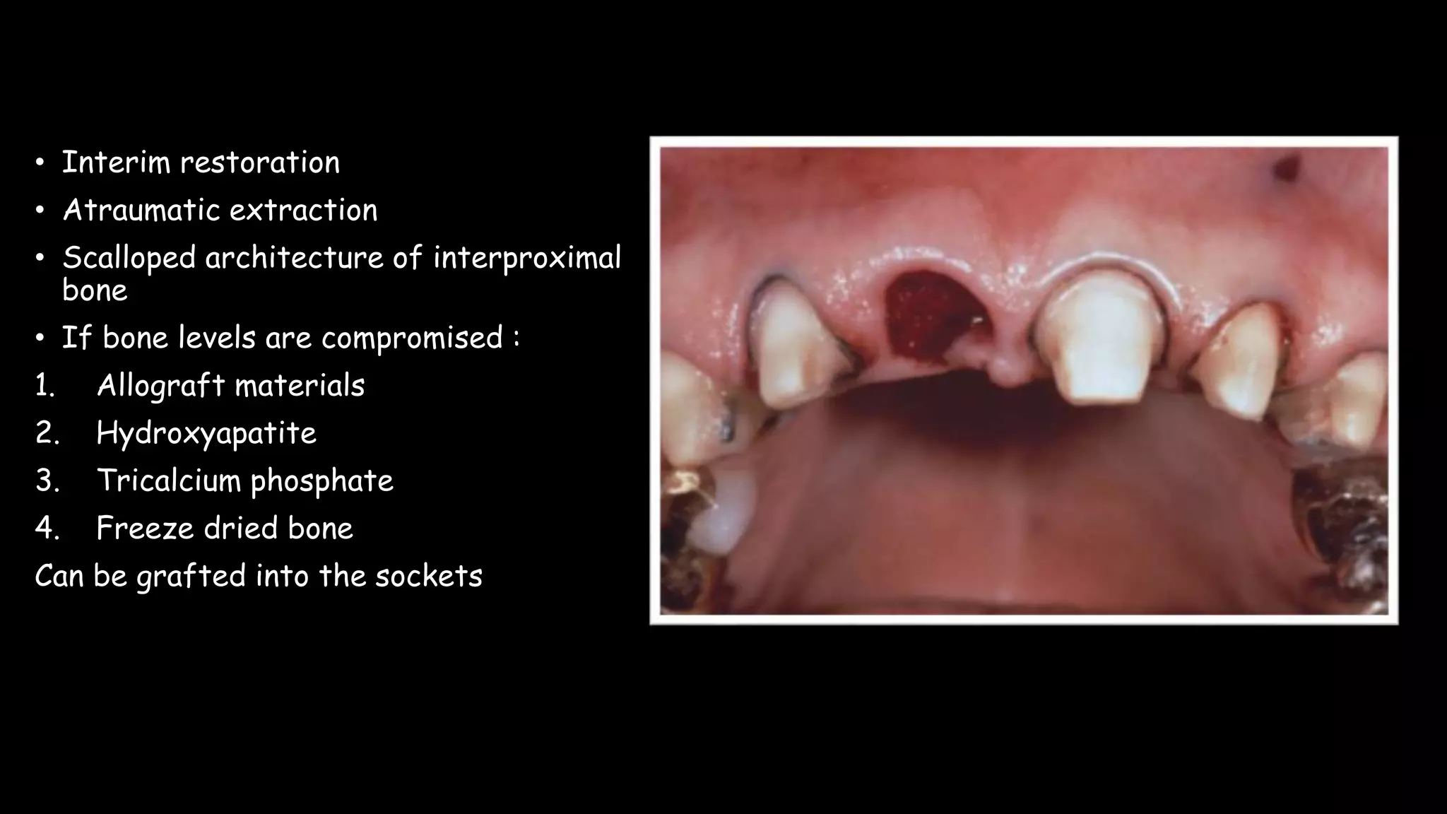 Pontic and pontic designs | PPTX