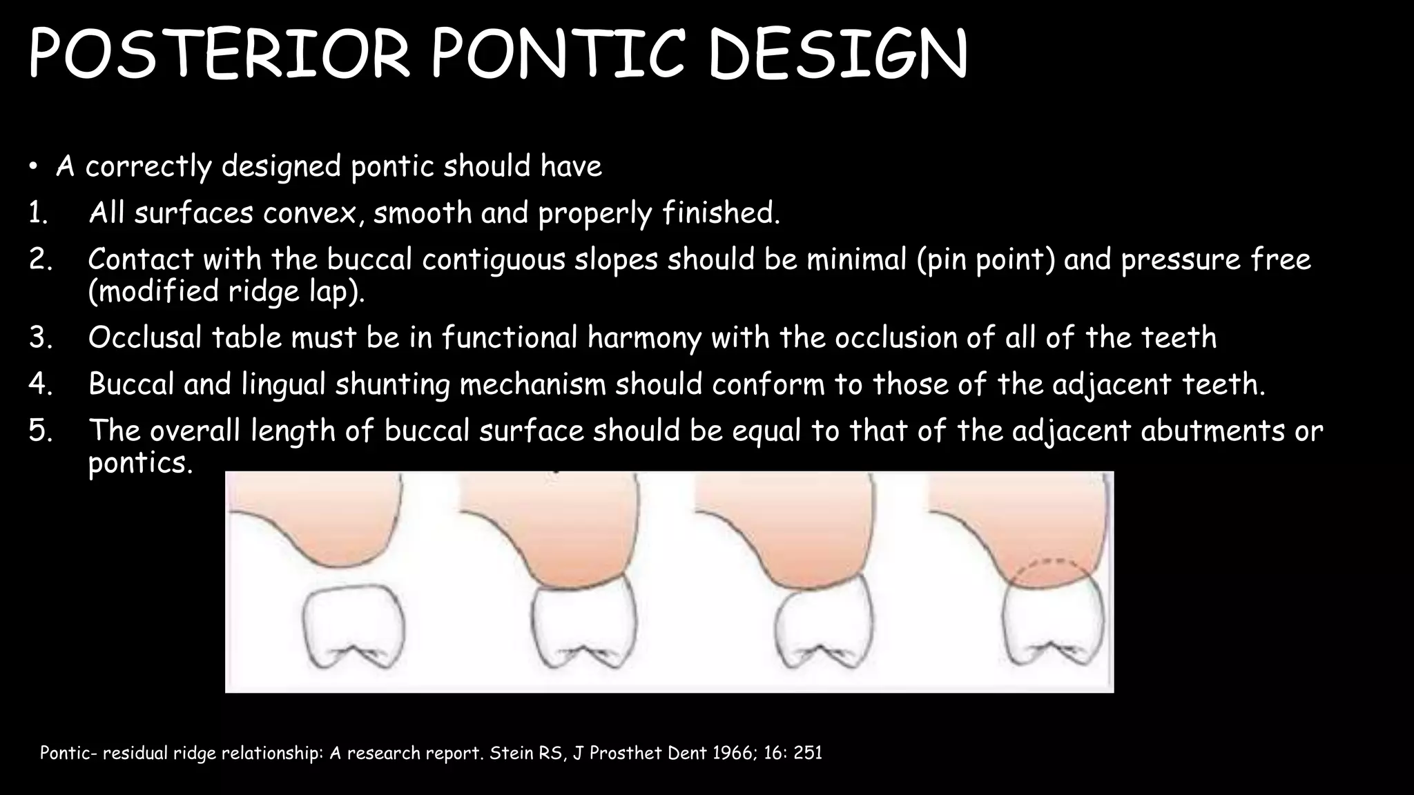 Pontic and pontic designs | PPTX | Oral care | Personal Care