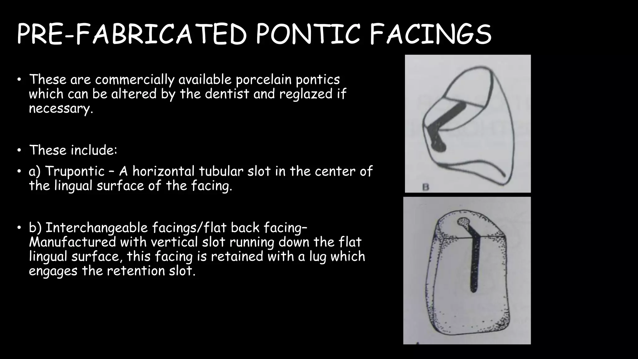 Pontic and pontic designs | PPTX
