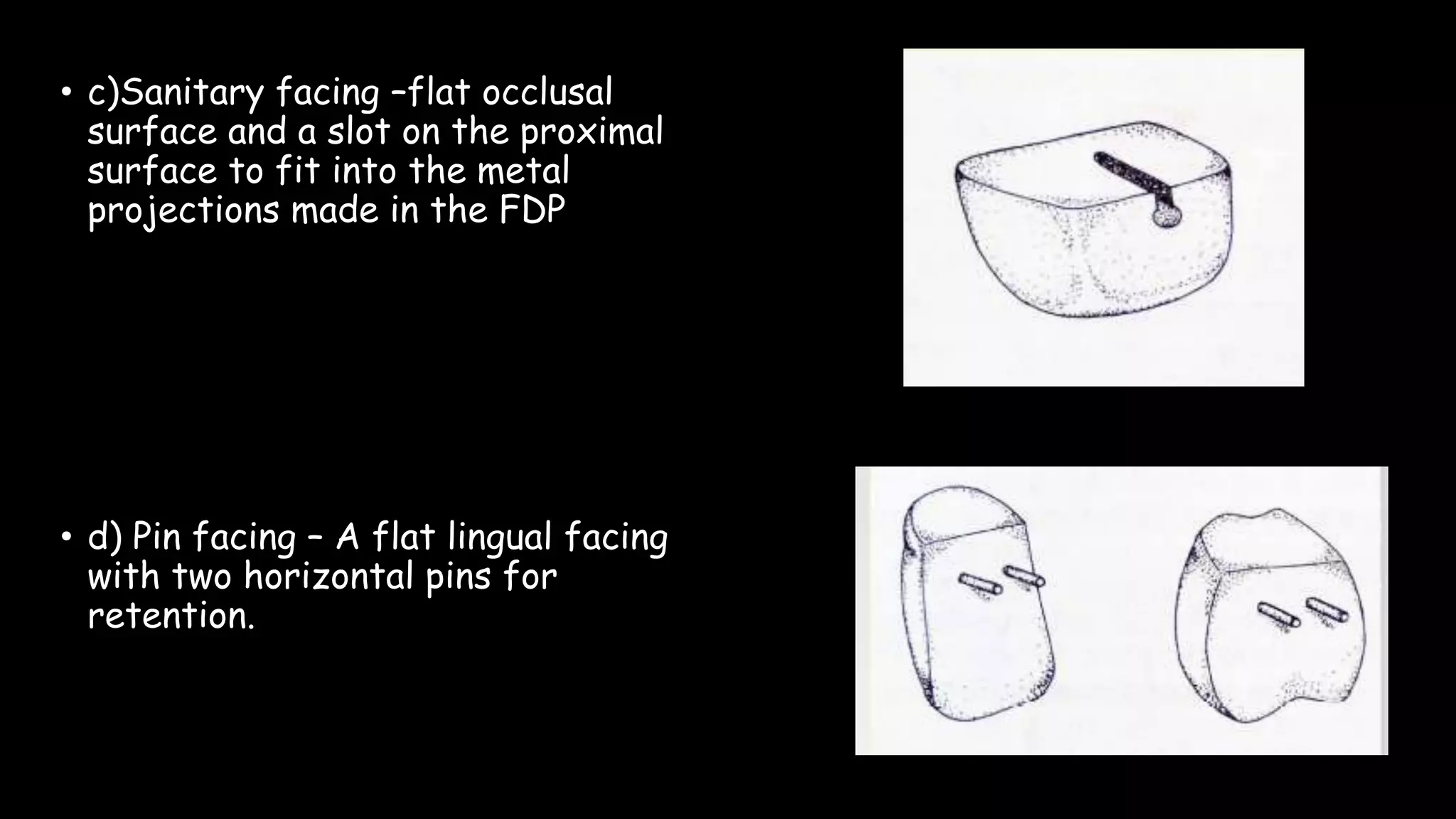 Pontic and pontic designs | PPTX