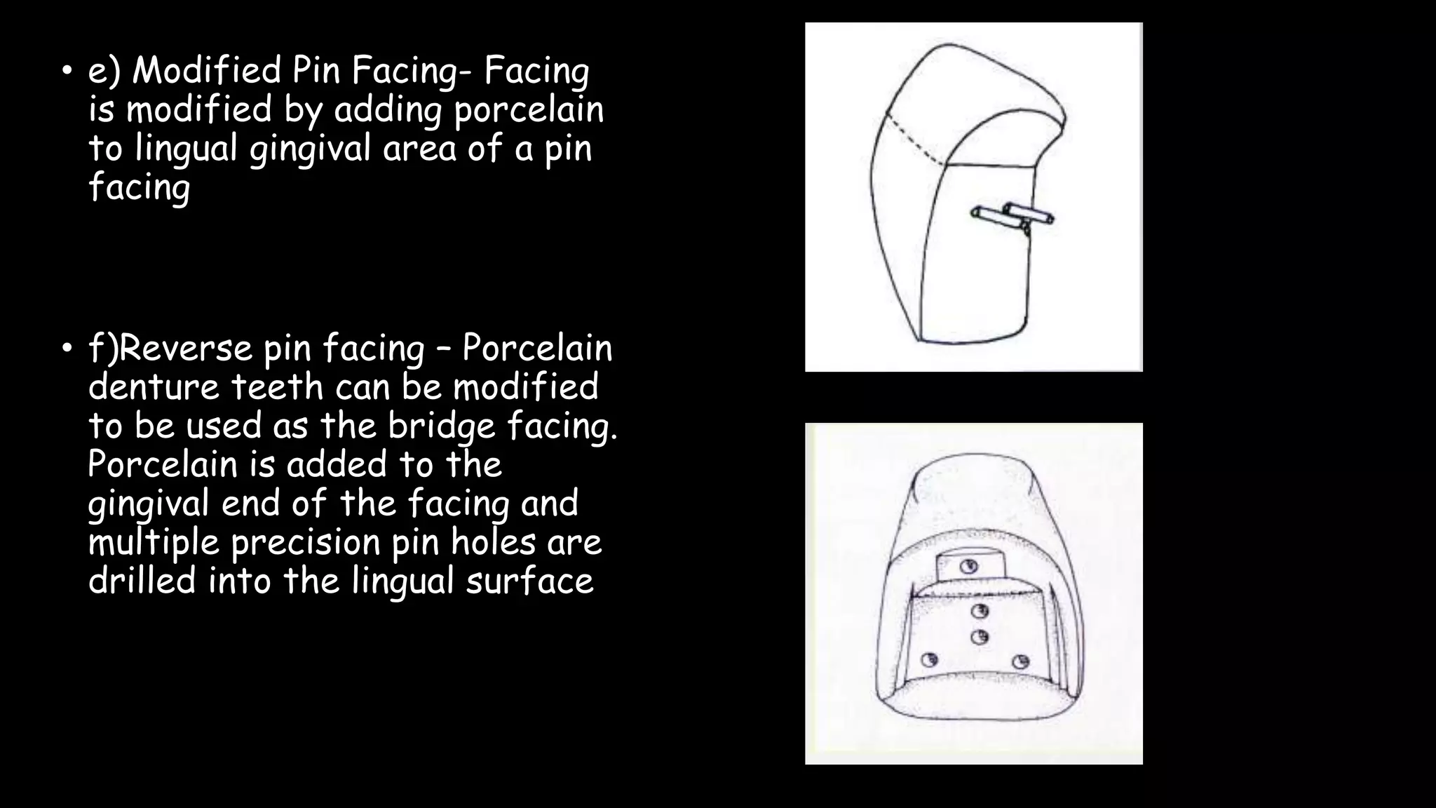 Pontic and pontic designs | PPTX