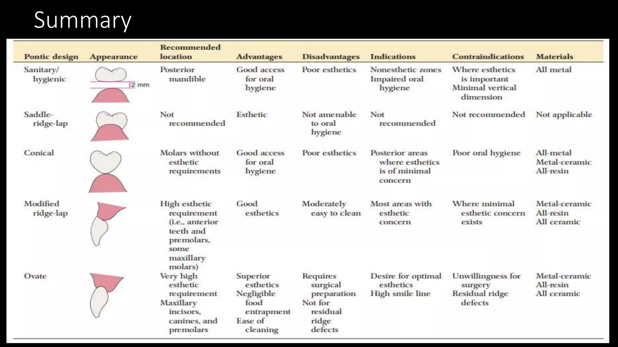 Pontic and pontic designs | PPTX | Oral care | Personal Care