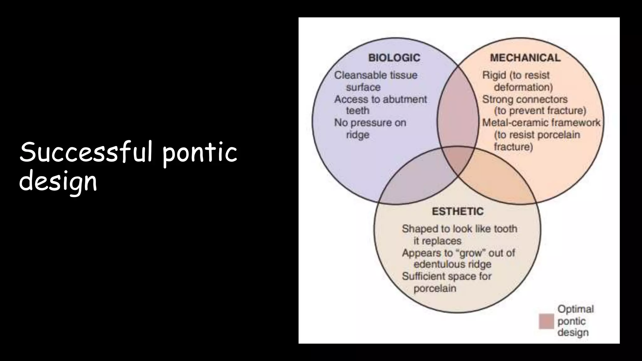 Pontic and pontic designs | PPTX