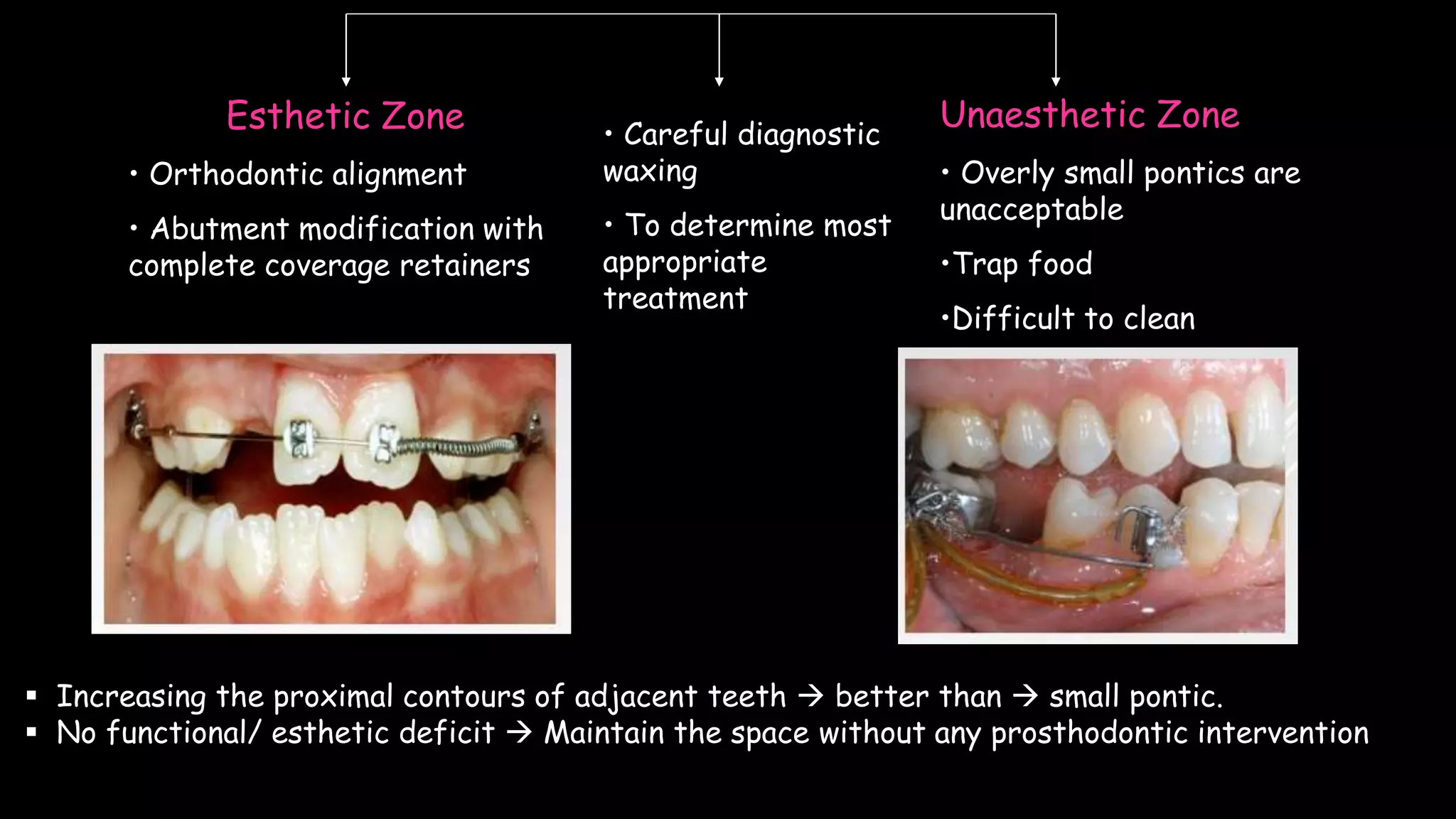 Pontic and pontic designs | PPTX