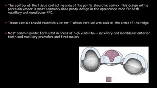 Pontic and pontic designs | PPTX