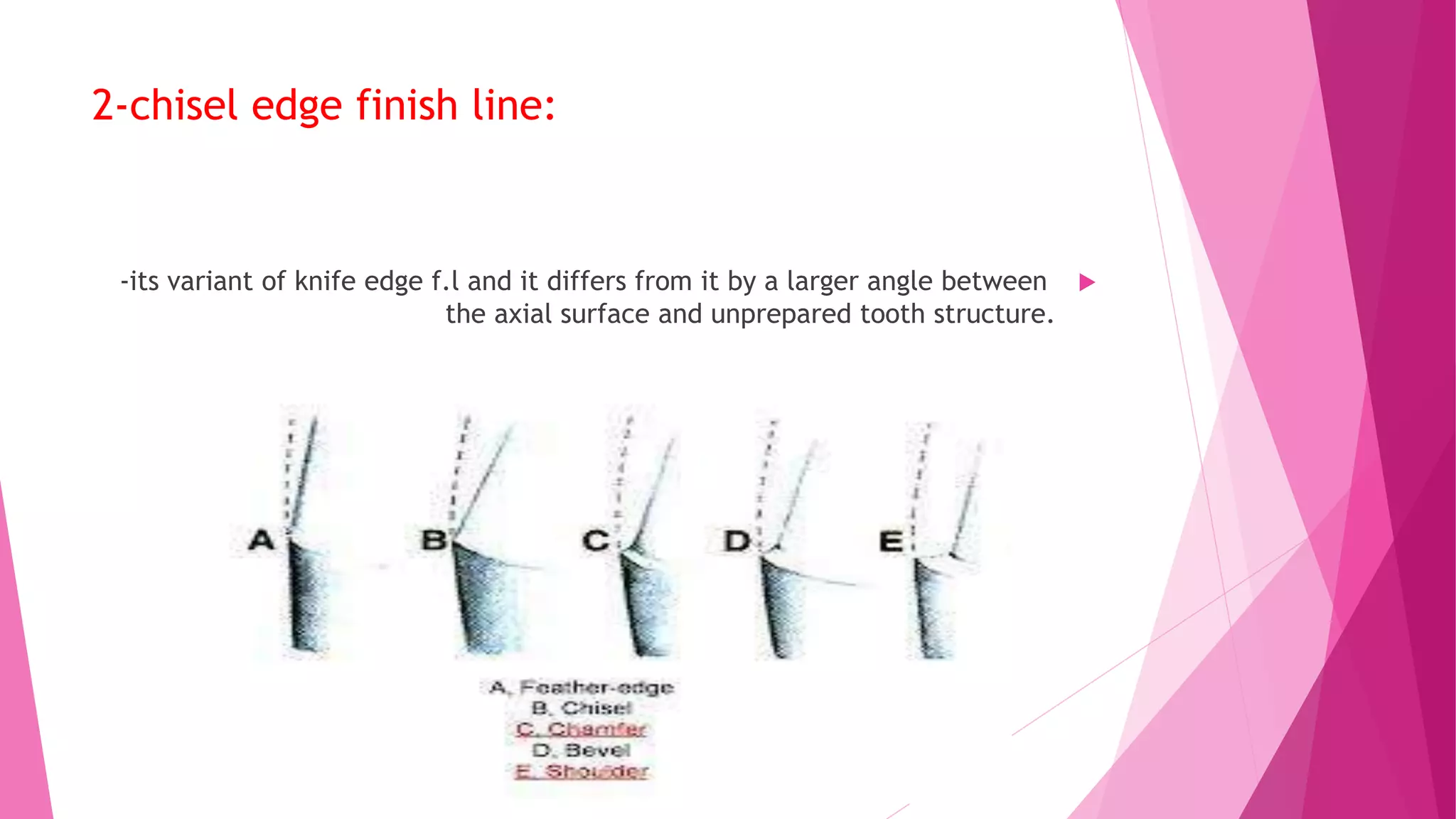 Pontic design and finish line.pptx