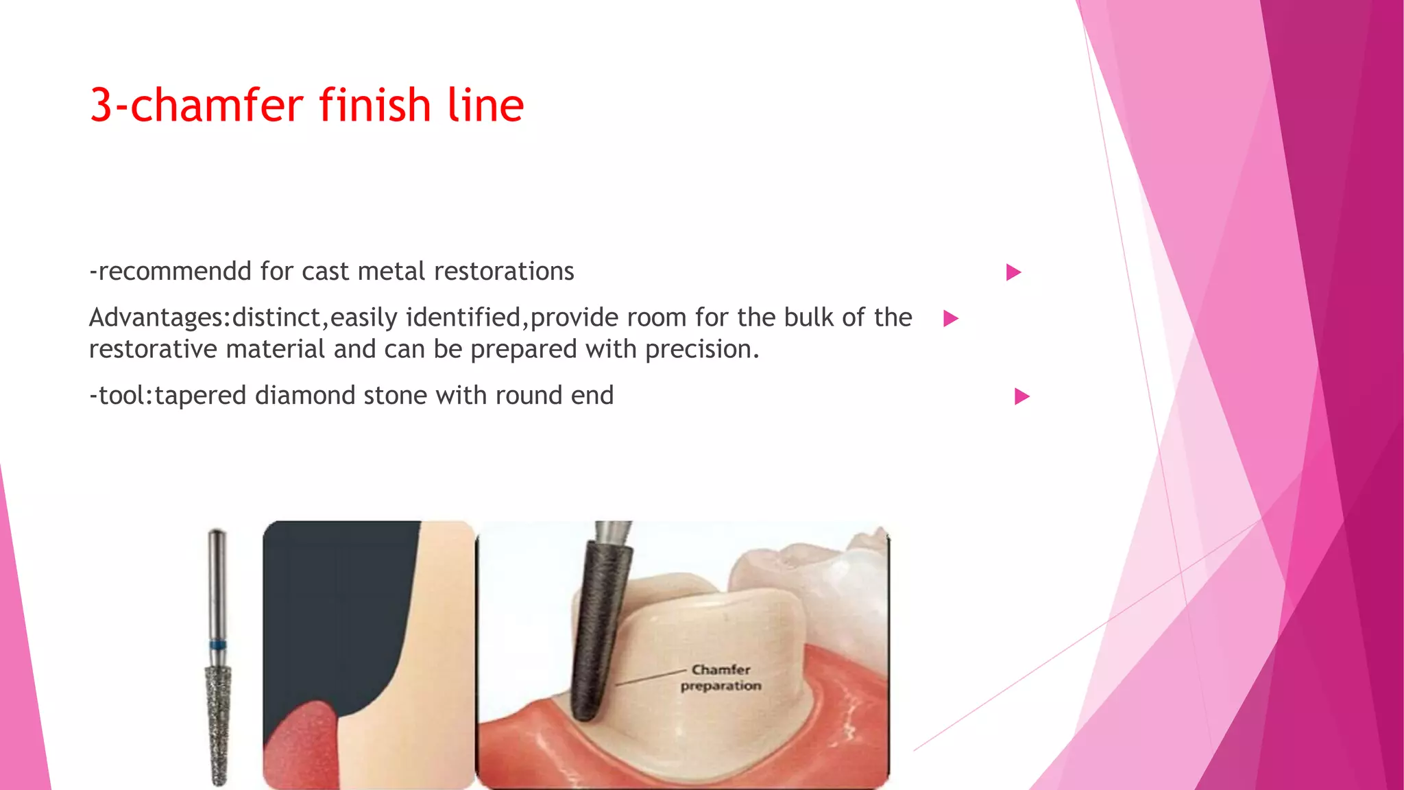 Pontic design and finish line.pptx