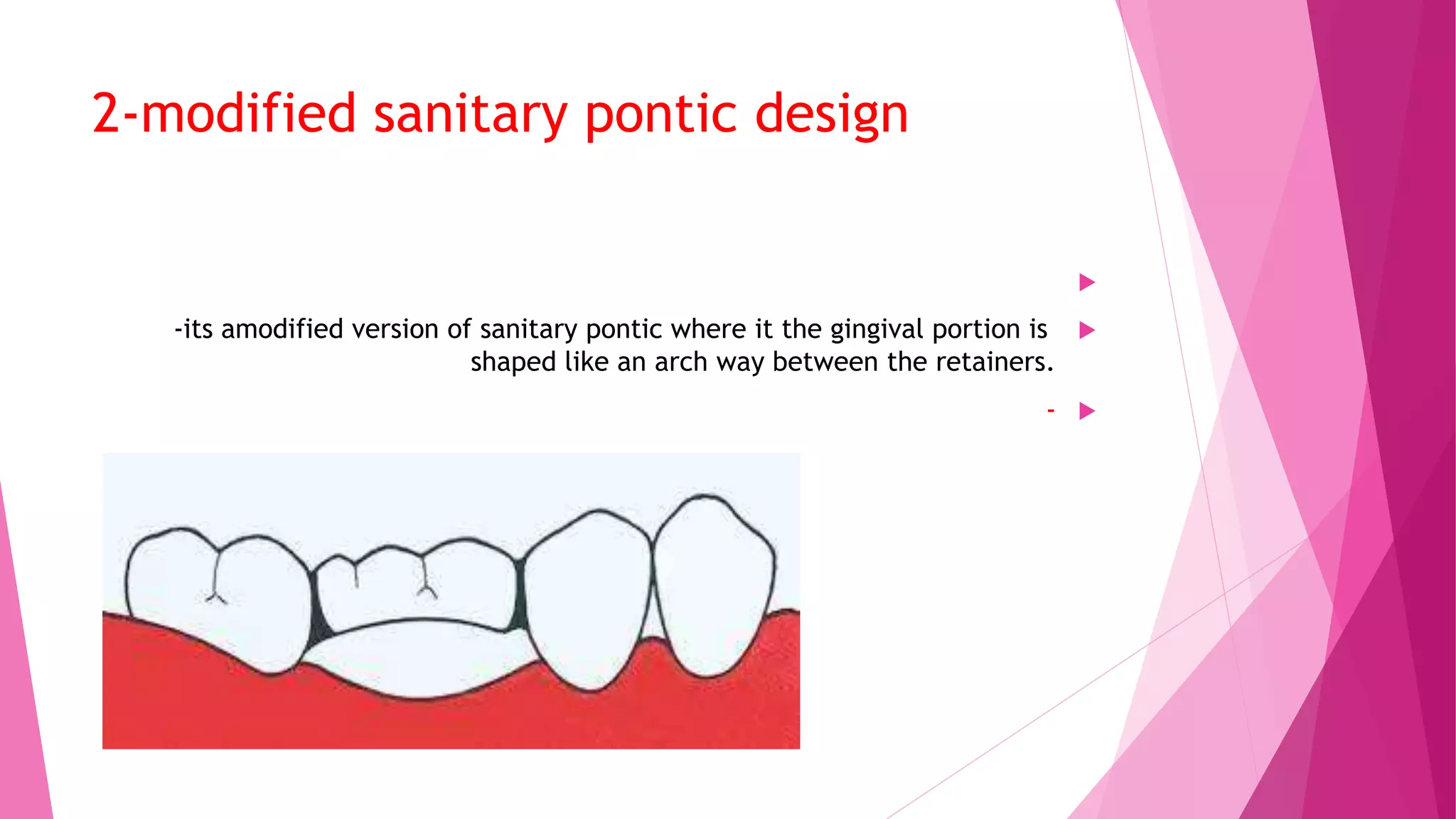 Pontic design and finish line.pptx