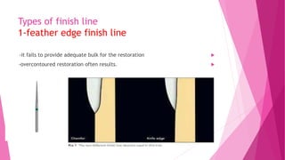 Pontic design and finish line.pptx