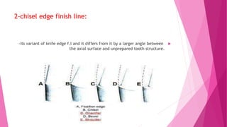 Pontic design and finish line.pptx