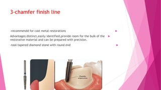 Pontic design and finish line.pptx