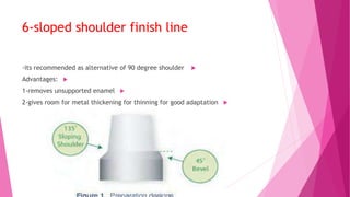 Pontic design and finish line.pptx