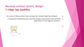 Pontic design and finish line.pptx