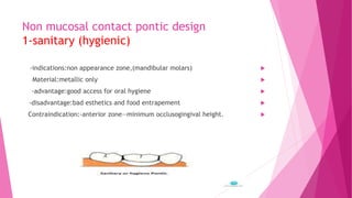 Pontic design and finish line.pptx