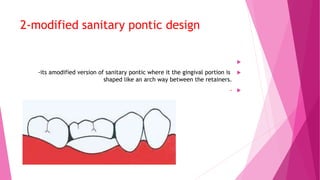 Pontic design and finish line.pptx